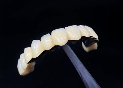 China Metalen kroon gesmolten porselein dat duurzaamheid en schoonheid combineert voor tandgezondheid for sale