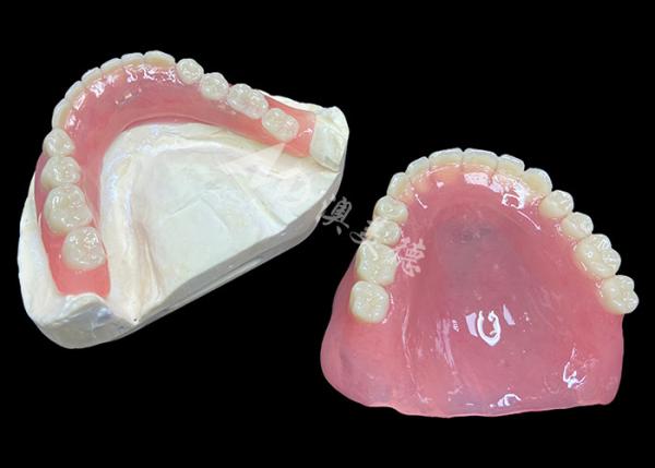 BPS suction dentures as an effective removable denture solution for enhanced comfort and stability