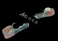 China Customized Cast Partial Dentures Precision Metal Framework For Optimal Fit And Functionality for sale