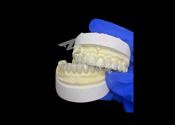 Quality IPS EMAX Porcelain Veneers For Natural Looking Front Teeth Restorations for sale