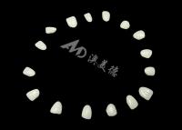 Quality IPS EMAX Porcelain Veneers For Natural Looking Front Teeth Restorations for sale