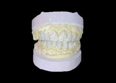 China Precision Crafted IPS e.max Veneers for Unrivaled Smile Transformations Delivering Exceptional Durability Aesthetics for sale