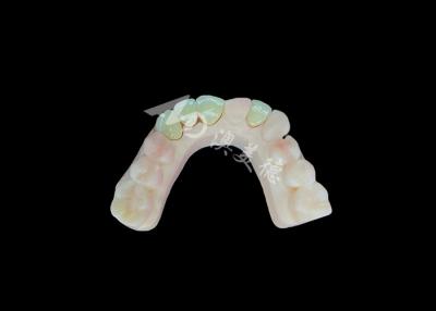 Cina Naturale e confortevole Corrispondenza Circonia corona di porcellana Cina laboratorio dentale ombra personalizzabile in vendita