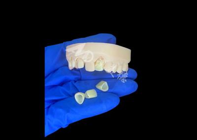 Cina Naturale e confortevole Corrispondenza Circonia corona di porcellana Cina laboratorio dentale ombra personalizzabile in vendita