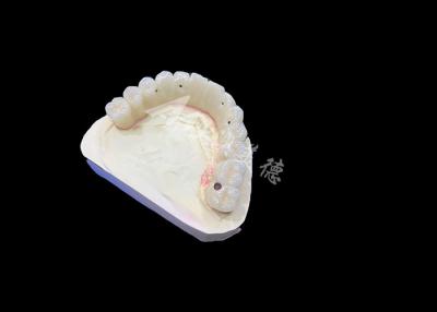 Cina Protesi protesi stabilità comfort e sorriso naturale in vendita