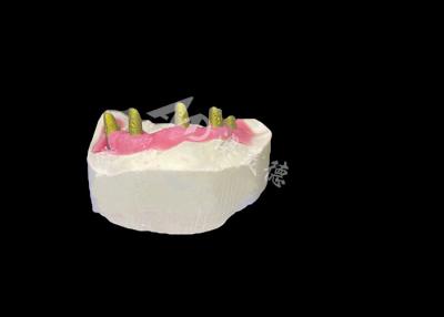Cina Protesi protesi stabilità comfort e sorriso naturale in vendita