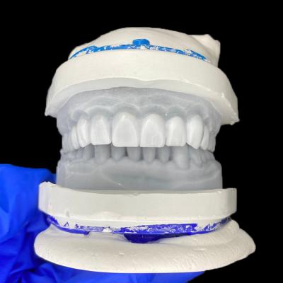 China Diagnostic Wax-Up for Porcelain Veneers for sale
