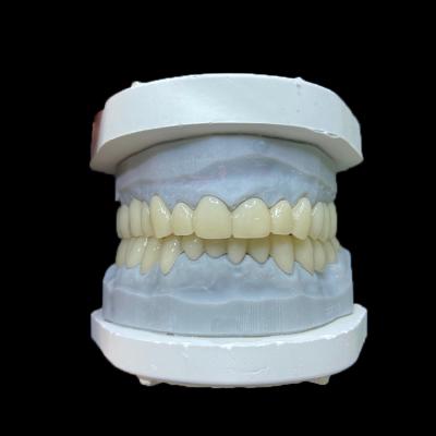 China PMMA Temporary Restorations CAD/CAM PMMA Crowns and Bridges for Provisional Dental Cases for sale