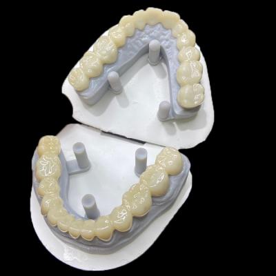 China PMMA Temporary Restorations CAD/CAM PMMA Crowns and Bridges for Provisional Dental Cases for sale