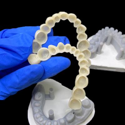 China PMMA Temporary Restorations CAD/CAM PMMA Crowns and Bridges for Provisional Dental Cases for sale