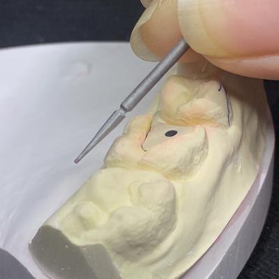 China Reinforce Your Restoration with Lock Pink Post Core Technology for sale