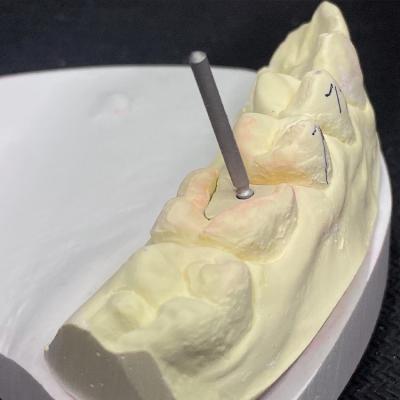 China Reinforce Your Restoration with Lock Pink Post Core Technology for sale