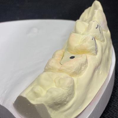 China Reinforce Your Restoration with Lock Pink Post Core Technology for sale