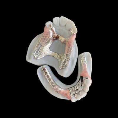 China Custom Metal Framework Partial Denture with Invisible Clasps for Precision Fit and Superior Esthetics for sale