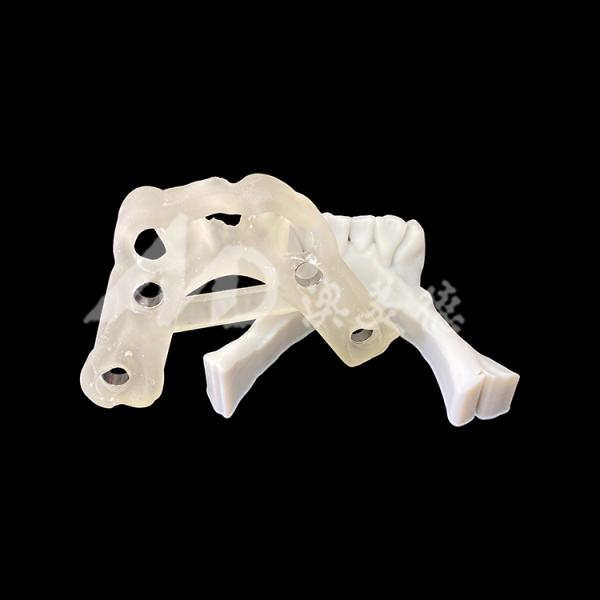 Quality Digital Implant Surgical Guide with Implant Planning Report for sale