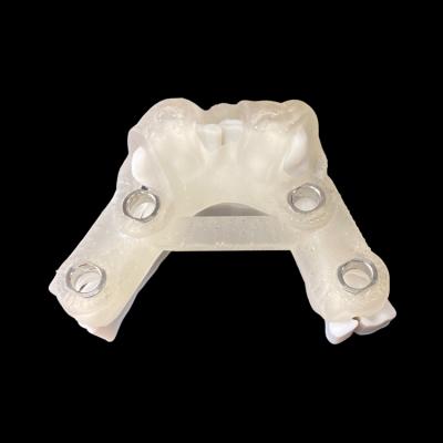 China Digital Implant Surgical Guide with Implant Planning Report for sale