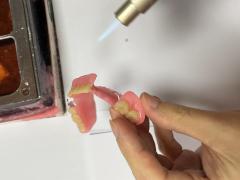 OEM Onzichtbare verwijderbare tandheelkundige prothesen Custom Acrylhars gedeeltelijke tandheelkundige prothese