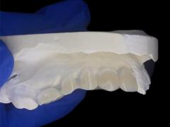 Valplast Flexíveis Dentes Parciais Projeto ajustável para melhorar a mastigação e a fala