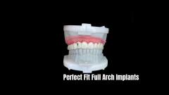 Full Arch Implant Supported Dentures Durable Precision Fit