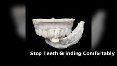 Custom Mini Night Guard for Teeth Grinding and Bruxism