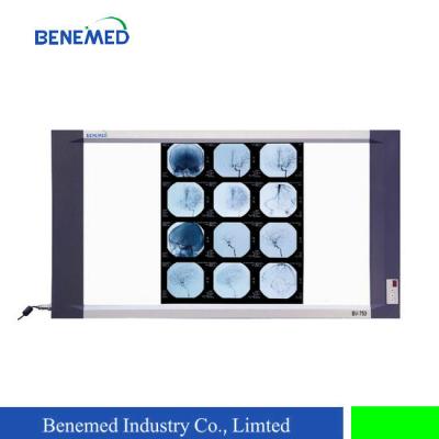China Ultraslim Medical LED X-ray film viewer Double section only 22mm thick ness with sensor function, digital function for sale