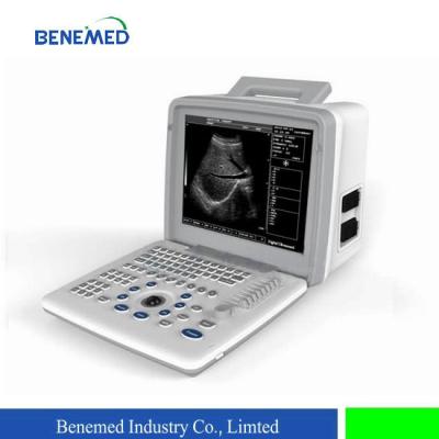 China Portable Digital Ultrasound Scannner black and white 12 inch LED screen for sale