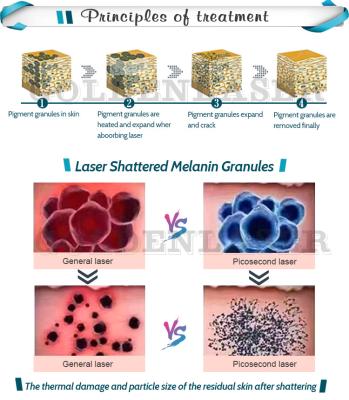 China Say Goodbye to Unwanted Hair with 1000W Handle Power Home Laser Hair Removal Device for sale