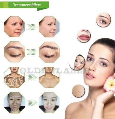 China Experience Smooth and Hair-Free Skin with Diode Laser Hair Removal Machine for sale