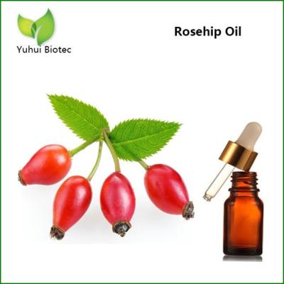 China best pure organic cold pressed rosehip oil in China,best rosehip oil for acne for sale
