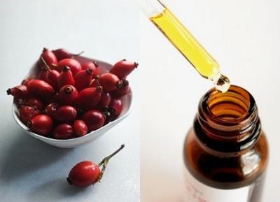 China rosehip extract,rosehip fruit oil,rosehip oil 100 pure,rosehip oil acne oily skin for sale