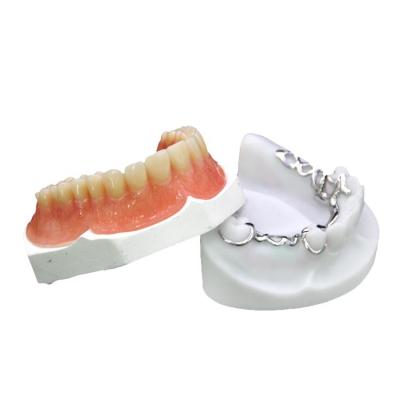 China IPS E.max Veneer/Crown China Outsourcing Dental for sale