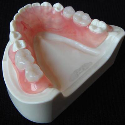 China Full Denture  China Dental Lab | FDA Certified Dental Lab | MYY Service Lab for sale