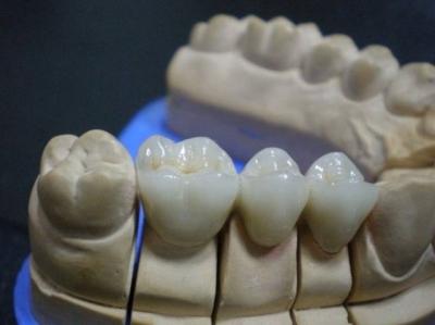 China China Dental Lab, Dental Lab China, China Outsourcing Dental Lab for sale