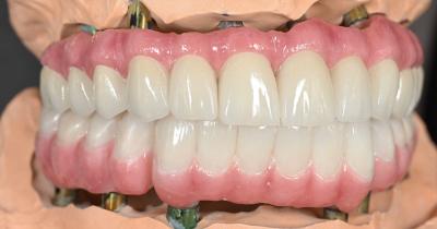 China Translucency Digital Dental Crowns Teeth High Esthetics Customized for sale