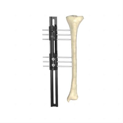 China Limb Lengthening Monolateral External Fixator R Type Combined External Fixator ISO for sale