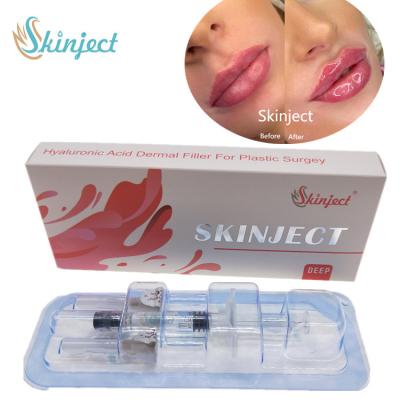 China Skinject Deep Hyaluronic Acid Dermal 2ml Lips Fillers Injectable for sale