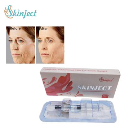 China Injection Dermal Lip Filler For Deep Facial Wrinkles And Folds for sale