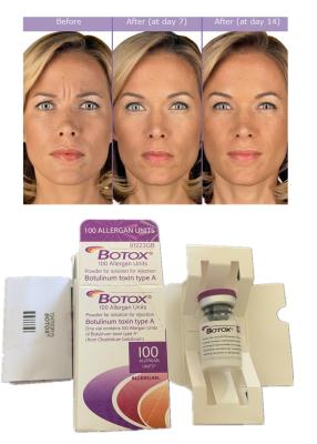 China Injections Allergan Botulinum Toxin 100IU Anti Wrinkles Dermal Filler for sale