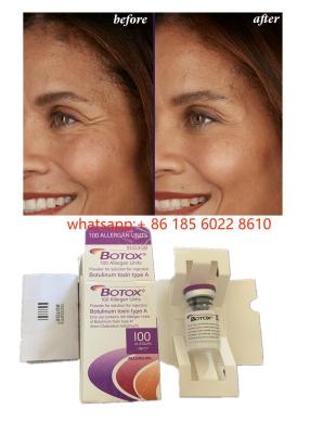 China Beauty Products Allergan 100units Botulinum Toxin  For Face Wrinkles Dermal Filler for sale