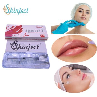China Skinject Kreuz des tiefe Hyaluronsäure-verband Hautfüller-2ml injizierbares zu verkaufen