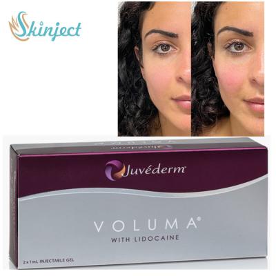 中国 頬骨のChinの輪郭を描くことのためのJuvederm Voluma 2x1ml HAの皮膚注入口 販売のため