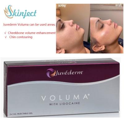 中国 顔の輪郭のためのJuvederm皮膚Volumaの注入口のHyaluronic酸 販売のため
