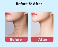 China Facial Microcurrent EMS Neck Face Lifting Massager Multi-function Beauty Eqiupment for sale