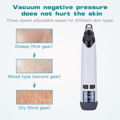 中国 ホットコンプレスブラックヘッド除去器とニキビ抽出ツールセット 2023 商用家用 販売のため