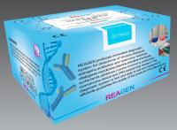 China 40 Test Serum / Plasma Sample IgG IgM Detection Reagent for sale