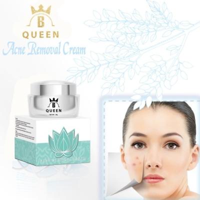 China Anti-Acne Cream Cosmetic Brand Name Face Acne Remove Night Cream for sale