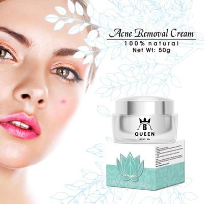 China Best Anti Acne Peeling Cream Gel Cream for sale