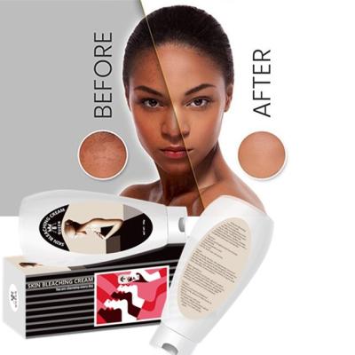 China Body Instant Whitening Cream 2018 Hot Sale Bleaching Cream for Unisex for sale