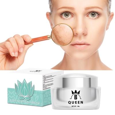 China Facial Cream Made in Japan Melasma and Freckle Removing Cream for sale