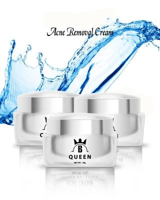 China 2019 New Melasma Cream for Anti Freckle Skin Whitening for sale